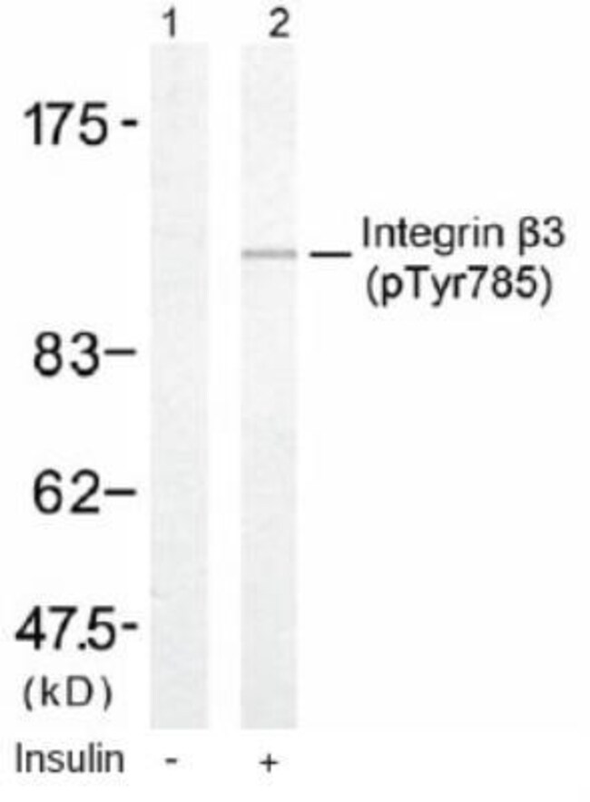INTEGRIN BETA 3/CD61 - 0.05 MG